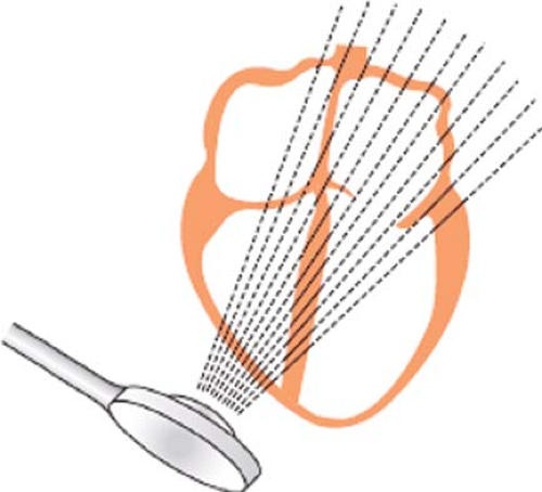 Lesson 1: How Are Ultrasound Images Produced? – Echo Physics