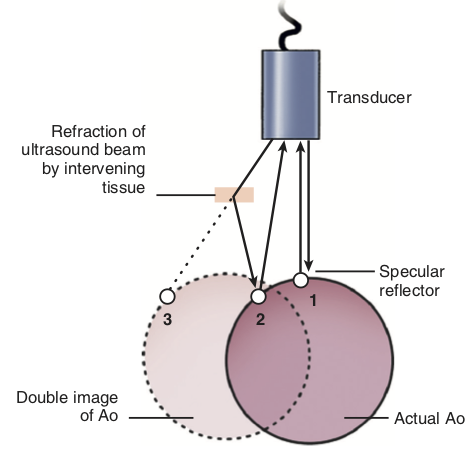 Lesson 3: Behavior of Ultrasound Waves in Tissue – Echo Physics