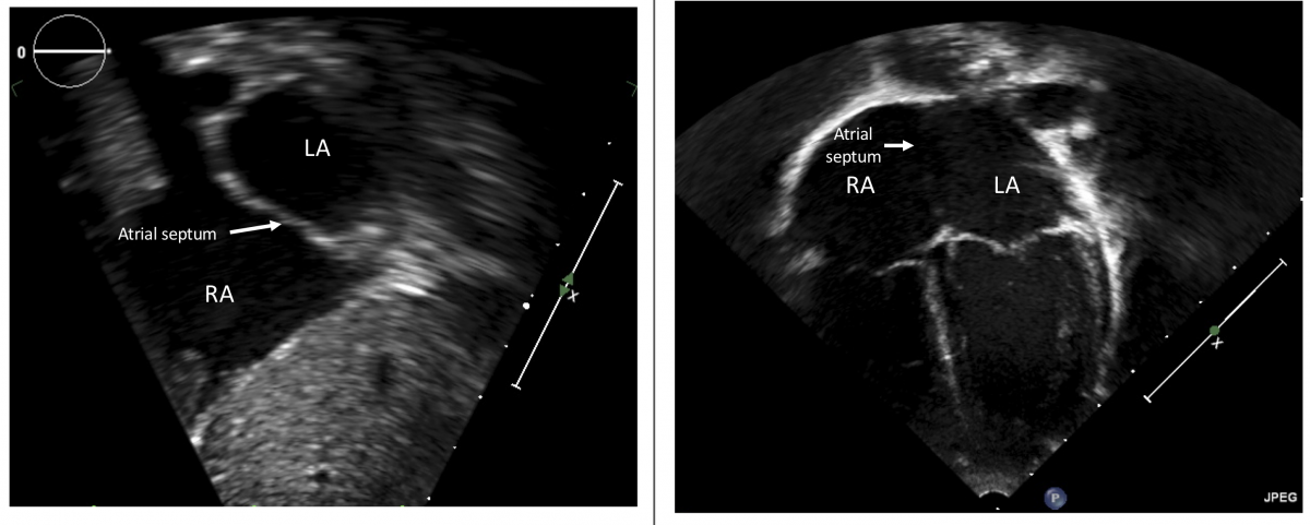 Lesson 3: Behavior of Ultrasound Waves in Tissue – Echo Physics