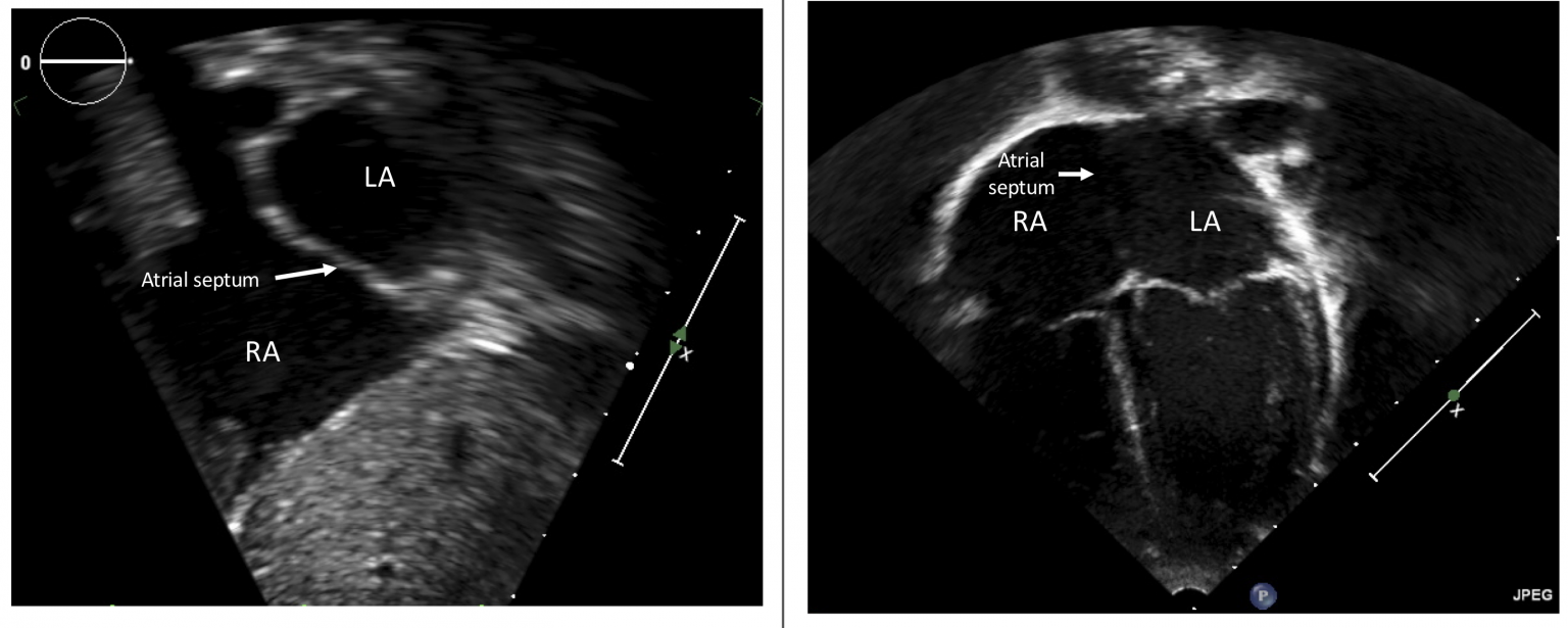 Lesson 3: Behavior of Ultrasound Waves in Tissue – Echo Physics