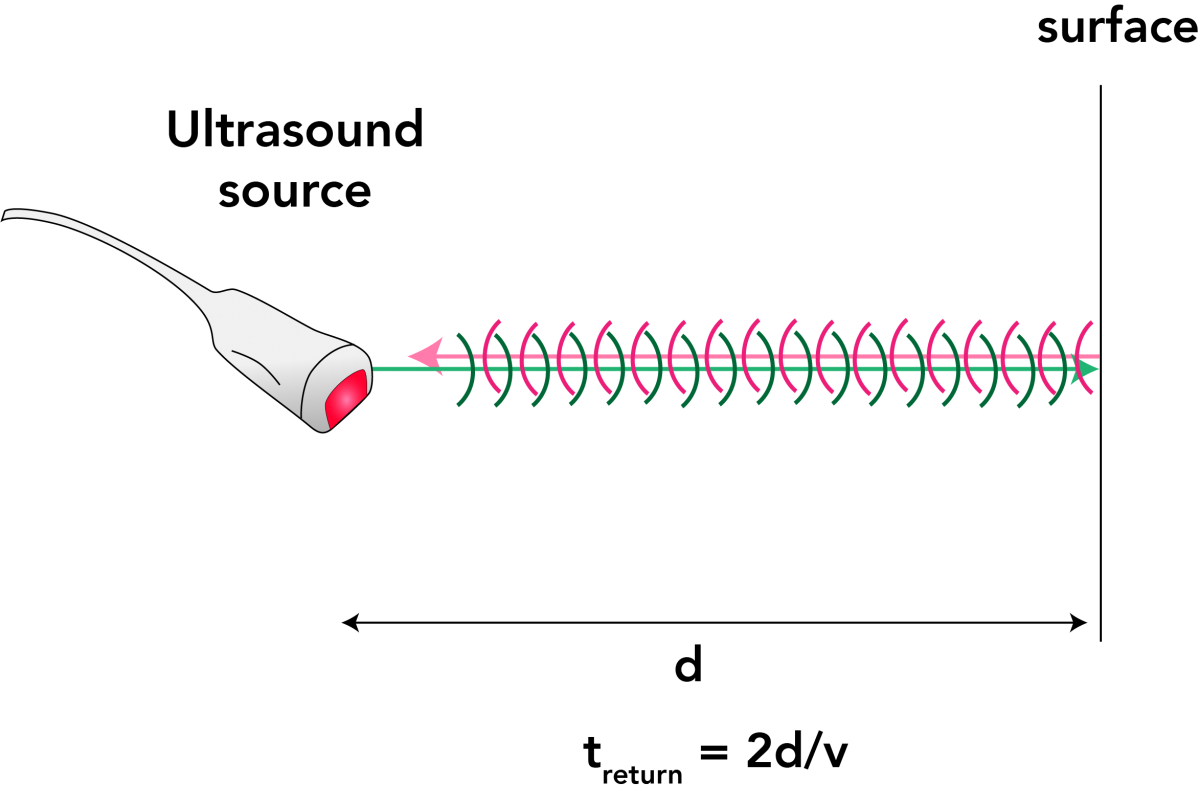 Lesson 1: How Are Ultrasound Images Produced? – Echo Physics Lesson 1: How Are Ultrasound Images Produced? – Echo Physics