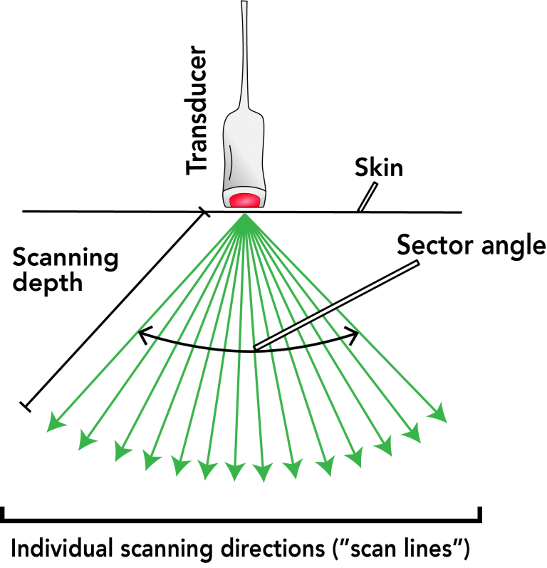 Lesson 1: How Are Ultrasound Images Produced? – Echo Physics