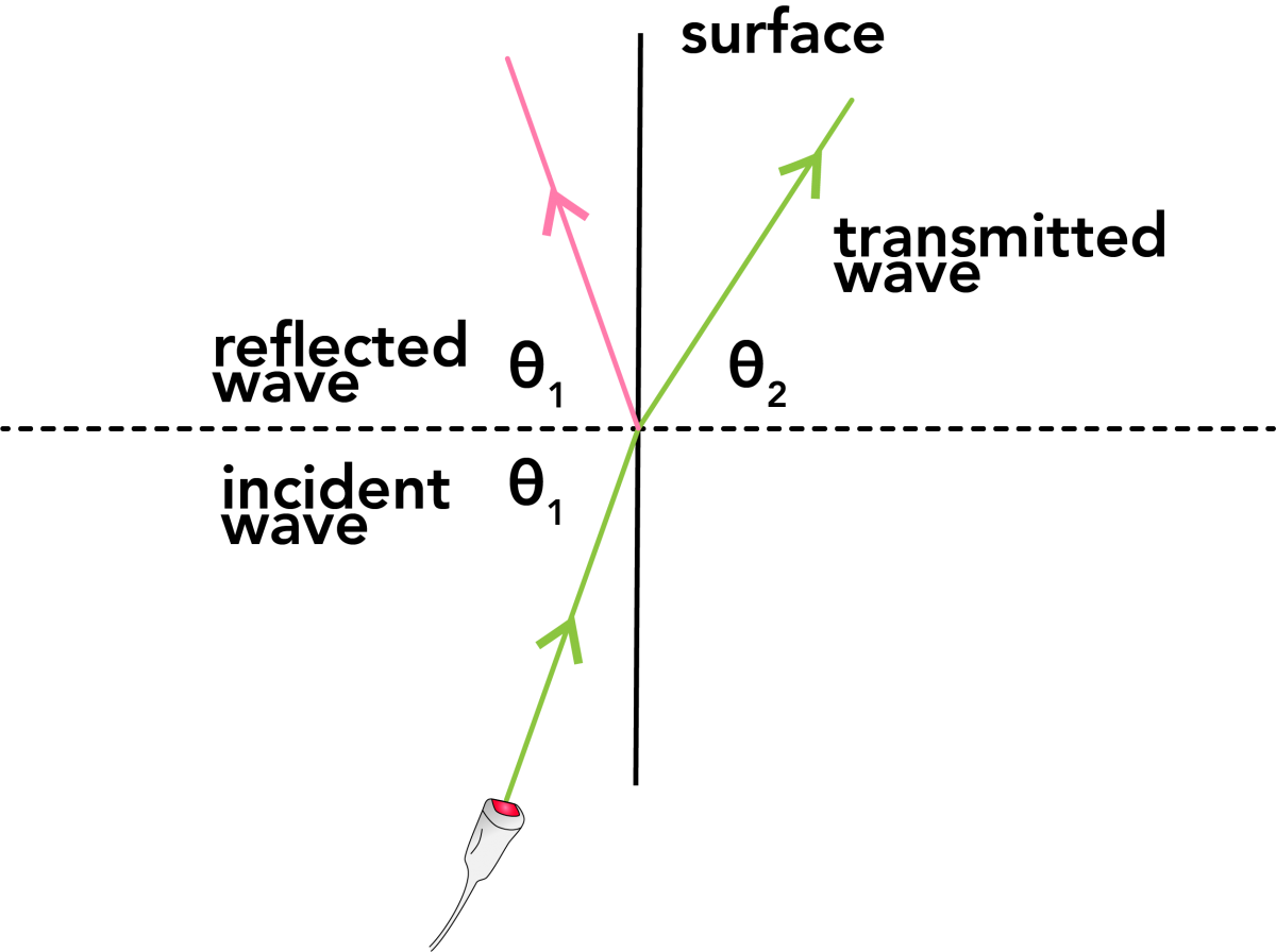 Lesson 3: Behavior of Ultrasound Waves in Tissue – Echo Physics